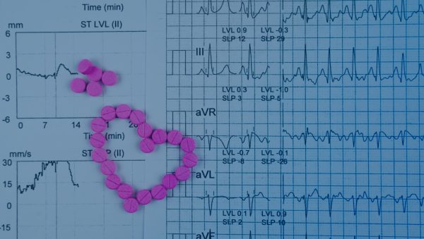 Exploring Primary Treatment Pathways for Atrial Fibrillation | Lucem Health